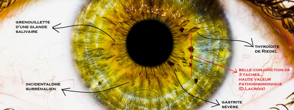 Formations - L'IRIDOLOGUE